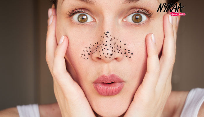Blackhead Removal- What Are Blackheads & Reasons For Blackheads | Nykaa ...